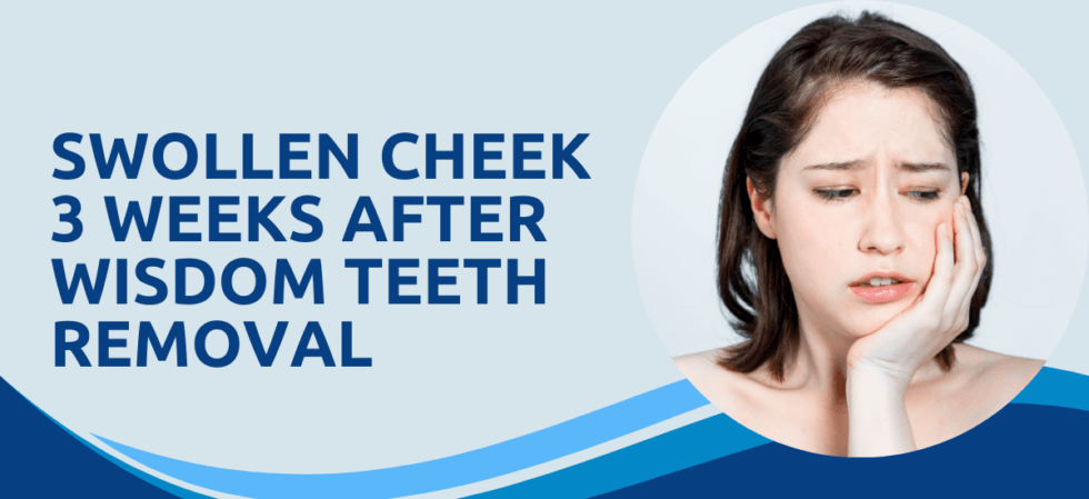 Swollen cheek 3 weeks after wisdom teeth removal | Dent Eazee